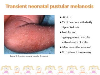 Pediatric Dermatology - Dr Maryam K Alnajem | PPTX