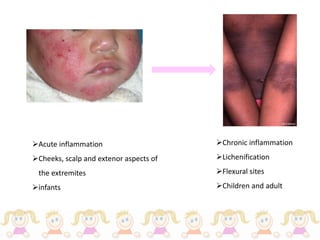 Pediatric Dermatology - Dr Maryam K Alnajem | PPTX
