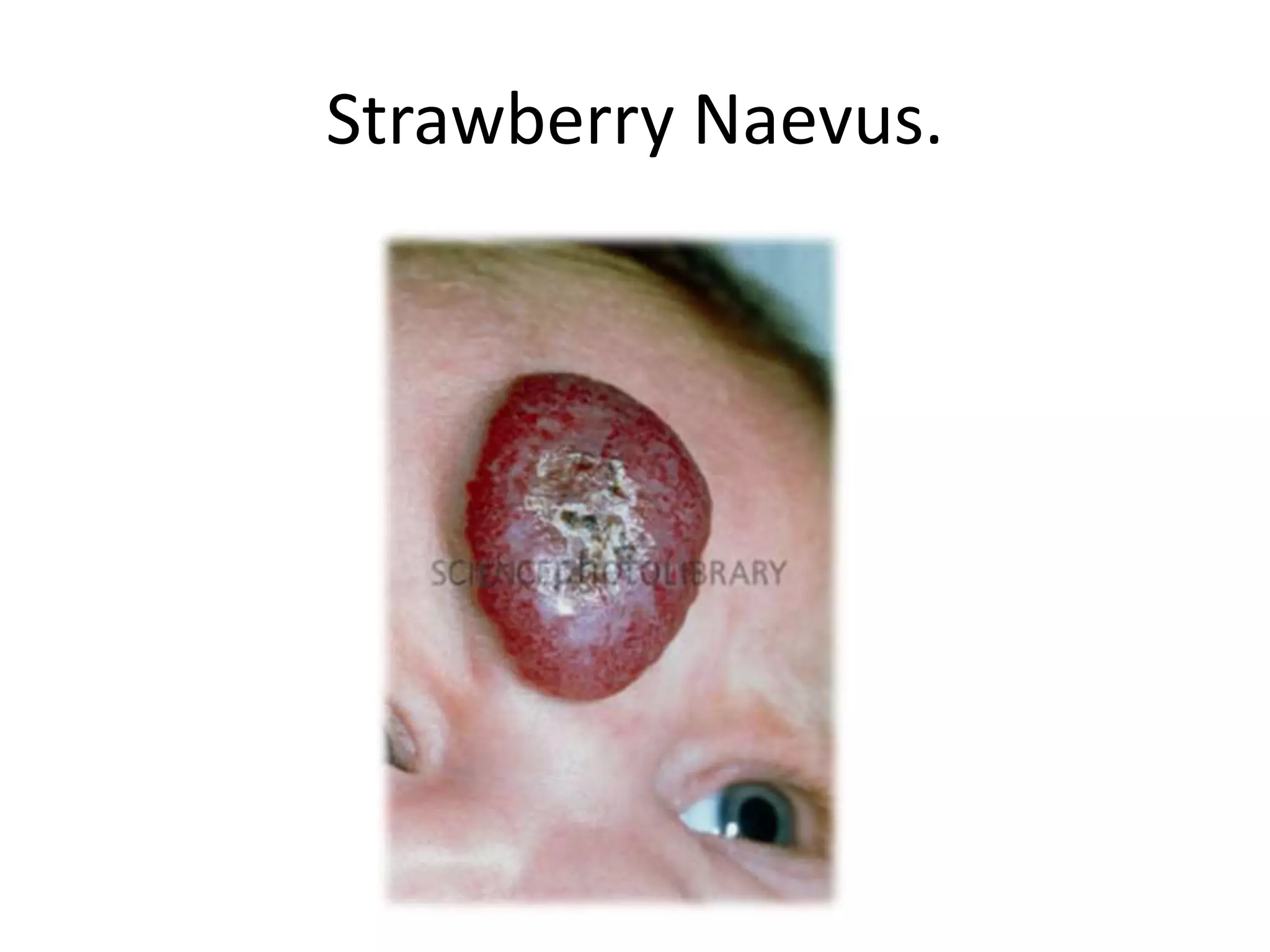 Pediatric dermatology | PPTX