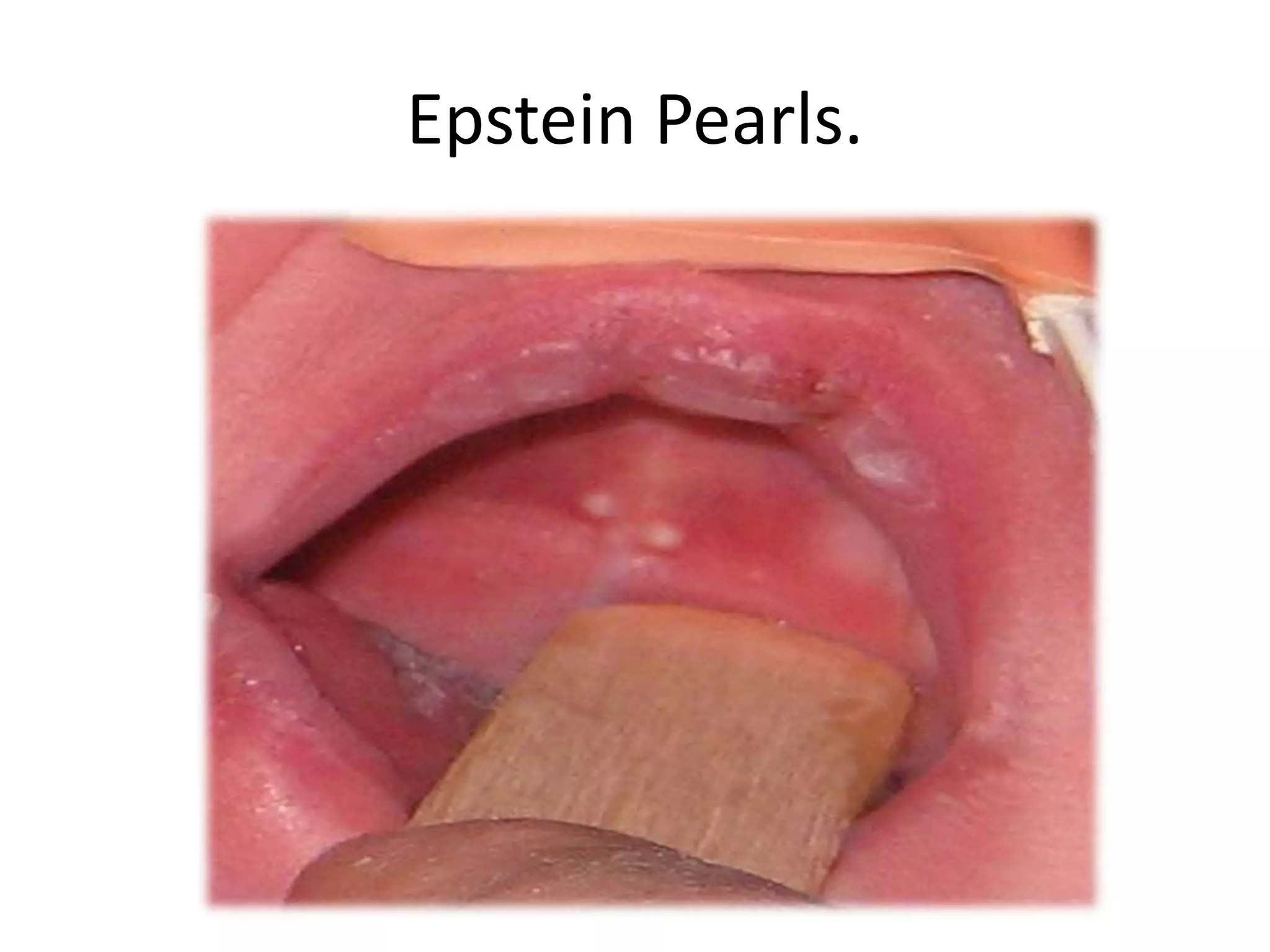 Pediatric dermatology | PPTX