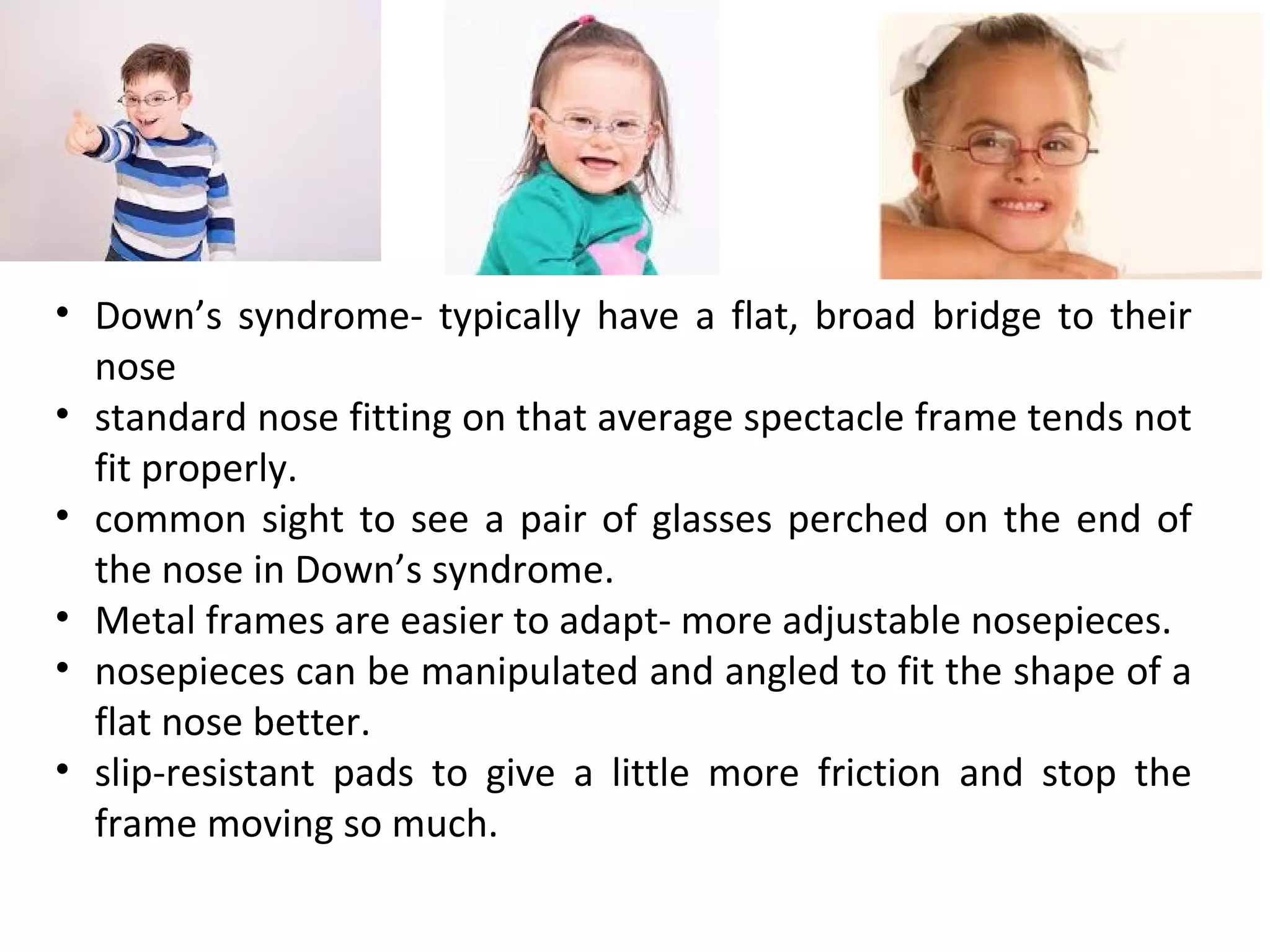 Pediatric Ophthalmic dispensing in different visual problems | PPT