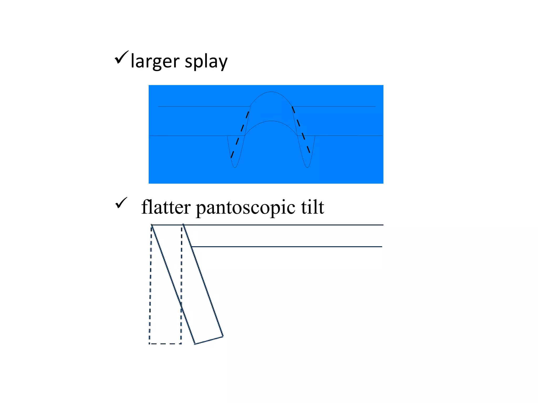 Pediatric Ophthalmic dispensing in different visual problems | PPT