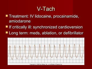 Pediatric dysrhythmias | PPT