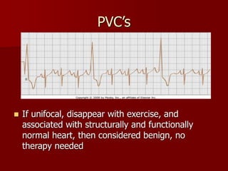 Pediatric Dysrhythmias.ppt