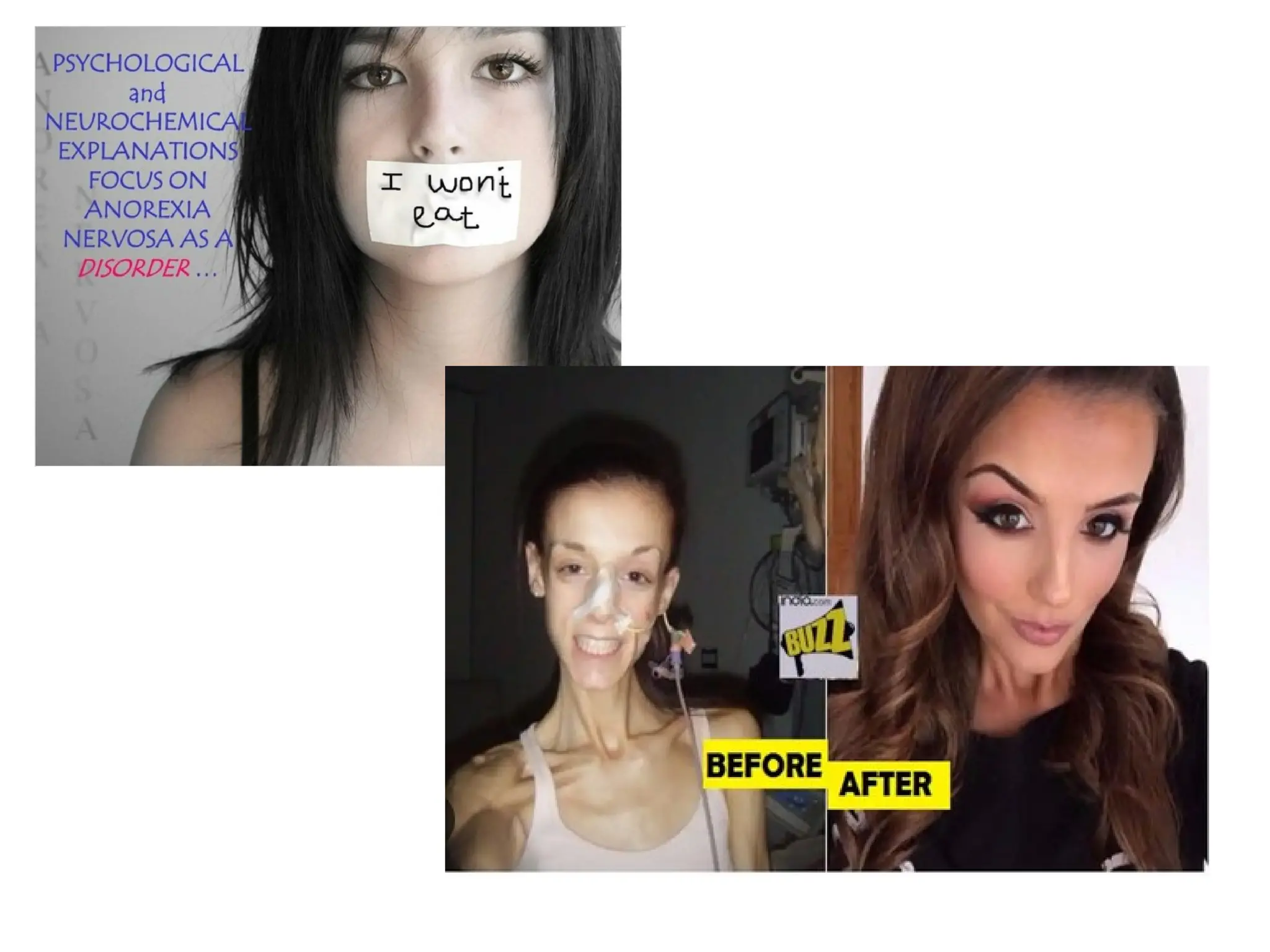 COMMON PEDIATRIC AGE GROUP - EATING DISORDERS.ppt