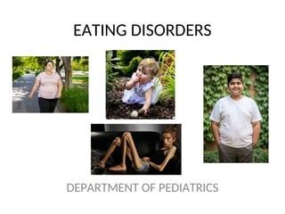 COMMON PEDIATRIC AGE GROUP - EATING DISORDERS.ppt