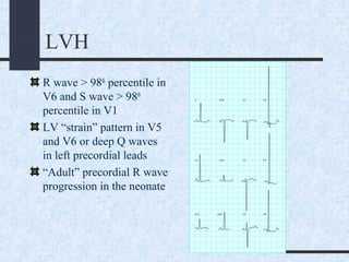 Pediatric ecg | PPT