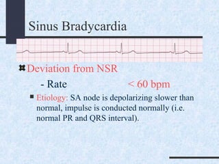 Pediatric ecg | PPT