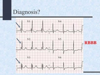 Pediatric ecg | PPT