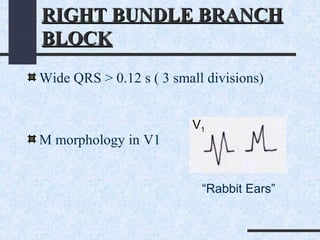 Pediatric ecg | PPT