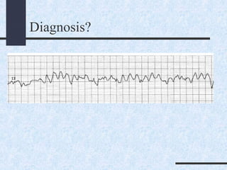 Pediatric ecg | PPT