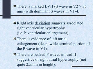 Pediatric ecg | PPT
