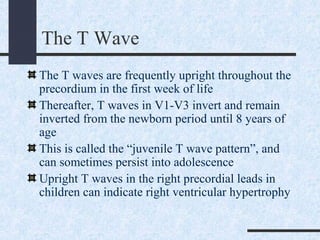 Pediatric ecg | PPT