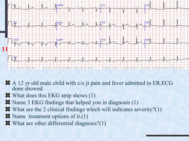 Pediatric ecg | PPT