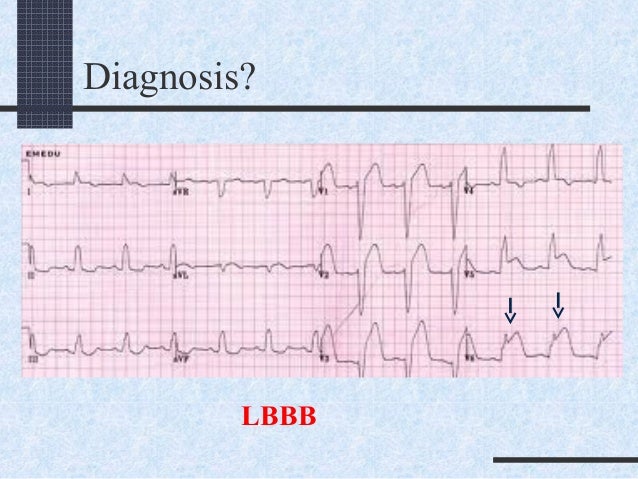 Pediatric ecg