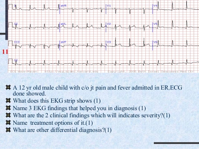 Pediatric ecg
