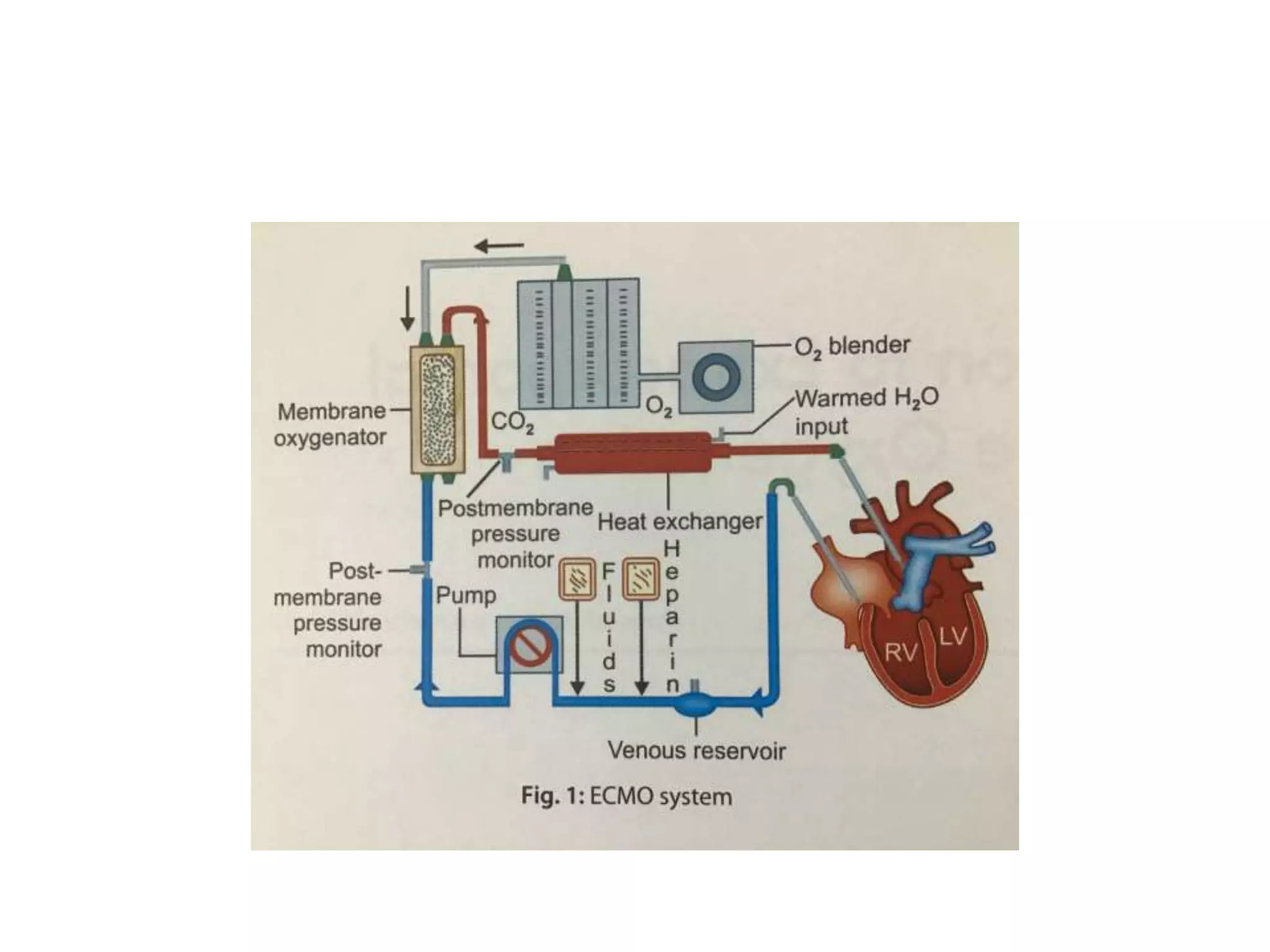 Pediatric ecmo | PPTX