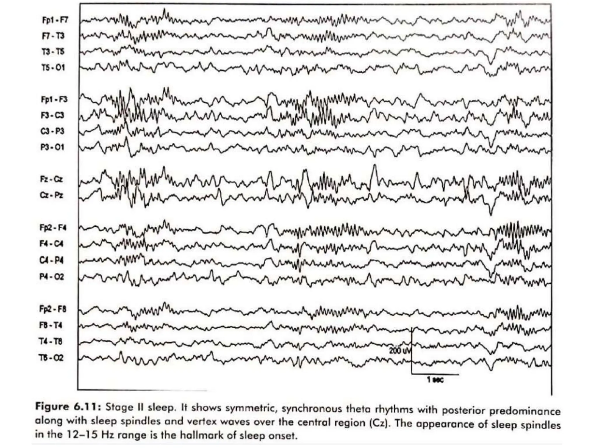 Pediatric EEG.pptx