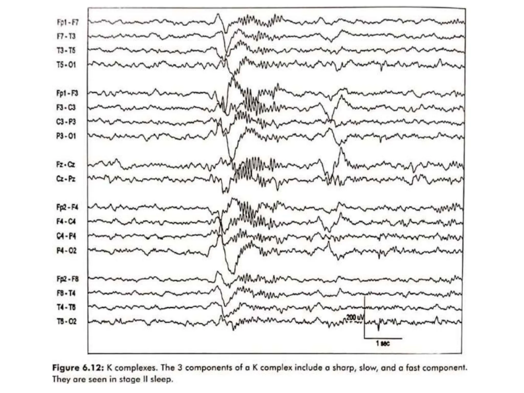 Pediatric EEG.pptx