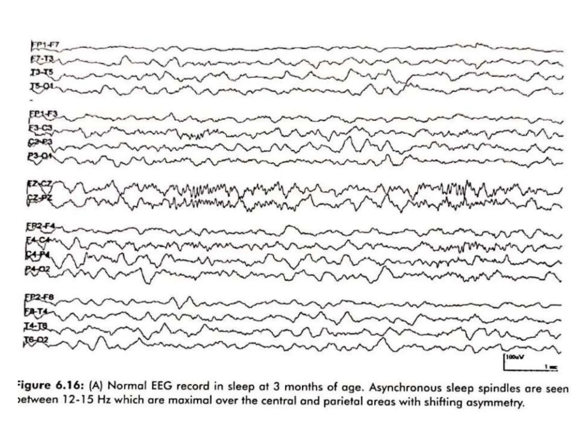 Pediatric EEG.pptx