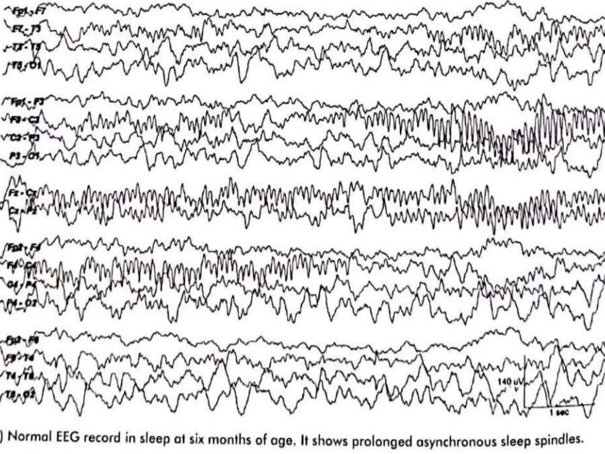 Pediatric EEG.pptx
