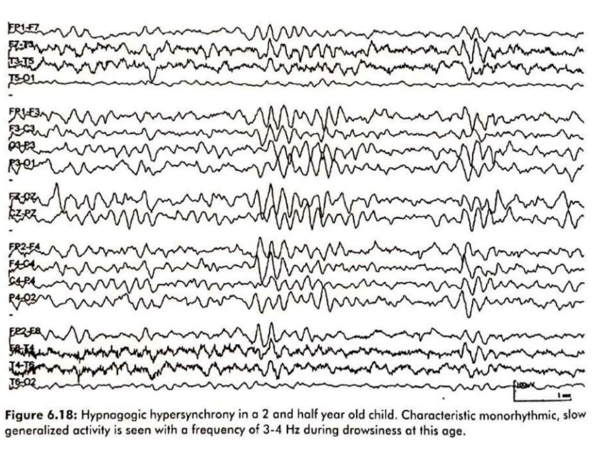 Pediatric EEG.pptx