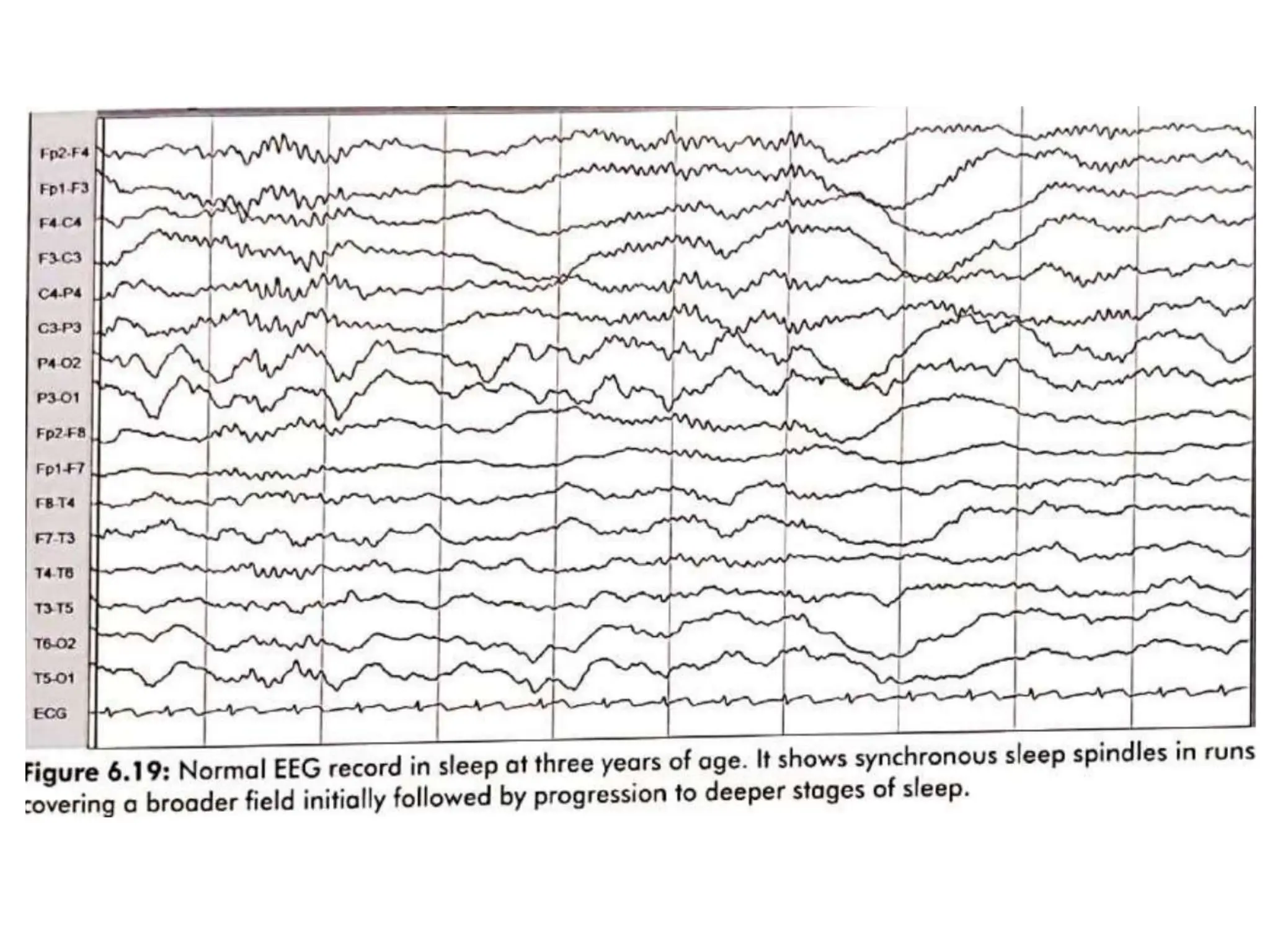 Pediatric EEG.pptx