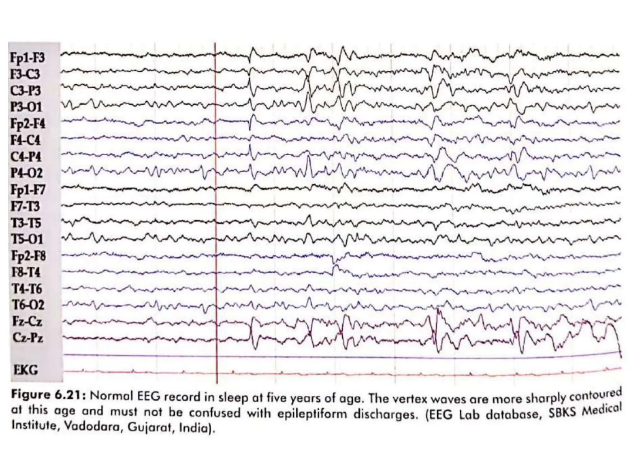 Pediatric EEG.pptx