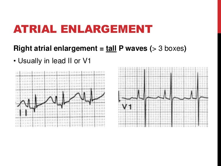 Pediatric EKGs