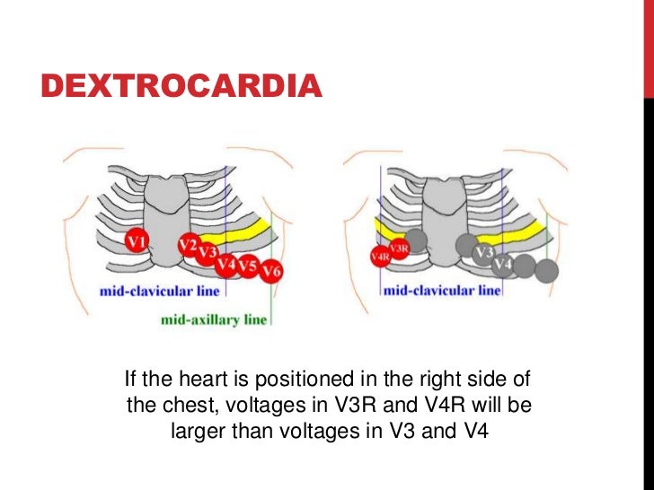 Pediatric EKGs