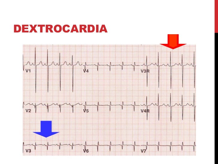 Pediatric EKGs