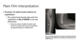 Pediatric Orthopedic Imaging Case Studies #7 Pediatric Elbow Fractures ...