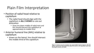 Pediatric Orthopedic Imaging Case Studies #7 Pediatric Elbow Fractures ...