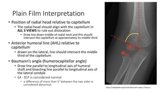 Pediatric Orthopedic Imaging Case Studies #7 Pediatric Elbow Fractures ...