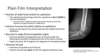 Pediatric Orthopedic Imaging Case Studies #7 Pediatric Elbow Fractures ...
