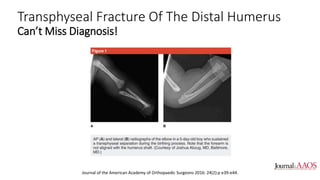 Pediatric Orthopedic Imaging Case Studies #7 Pediatric Elbow Fractures ...