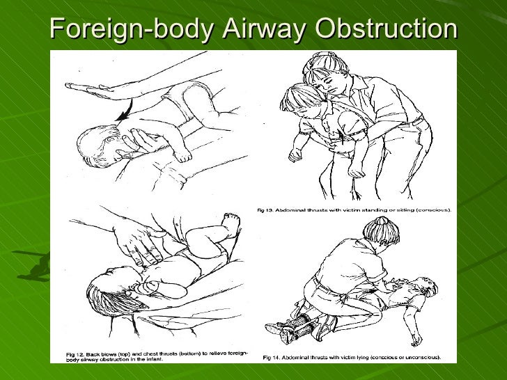 Pediatric emergencies
