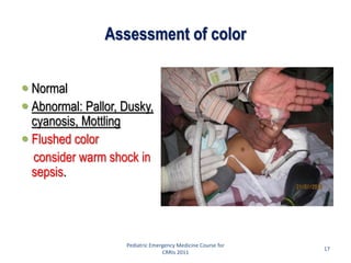 Paediatric emergencies in daily day.pptx