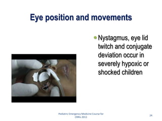 Paediatric emergencies in daily day.pptx