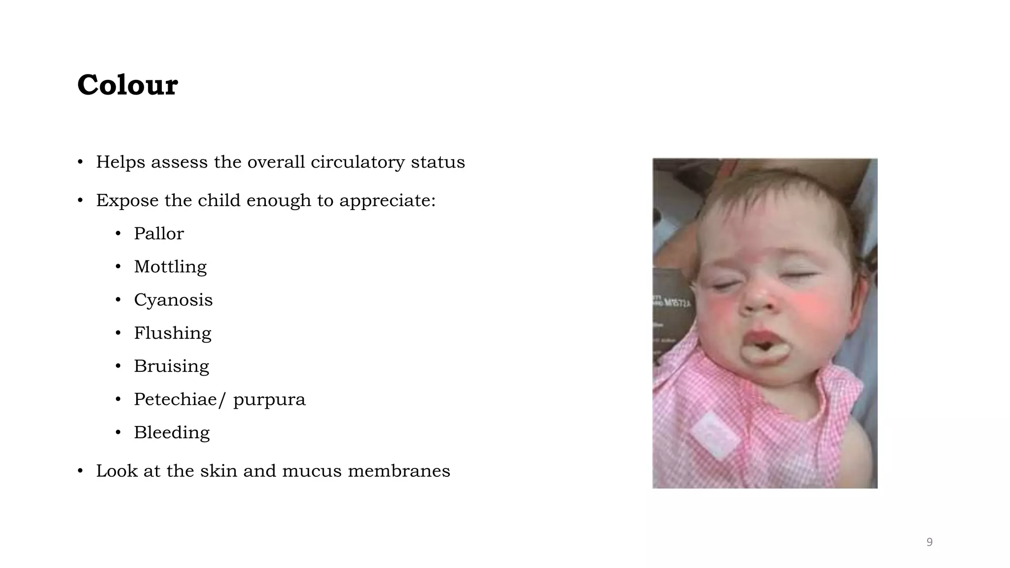 Pediatric Emergencies Mx Approach | PPTX