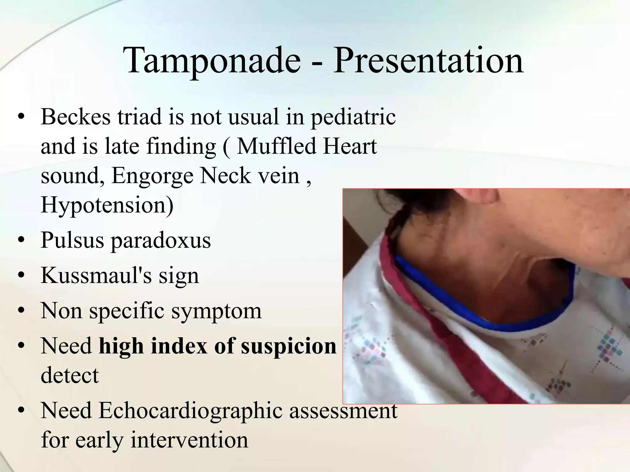 Pediatric Cardiovascular emergency | PPTX