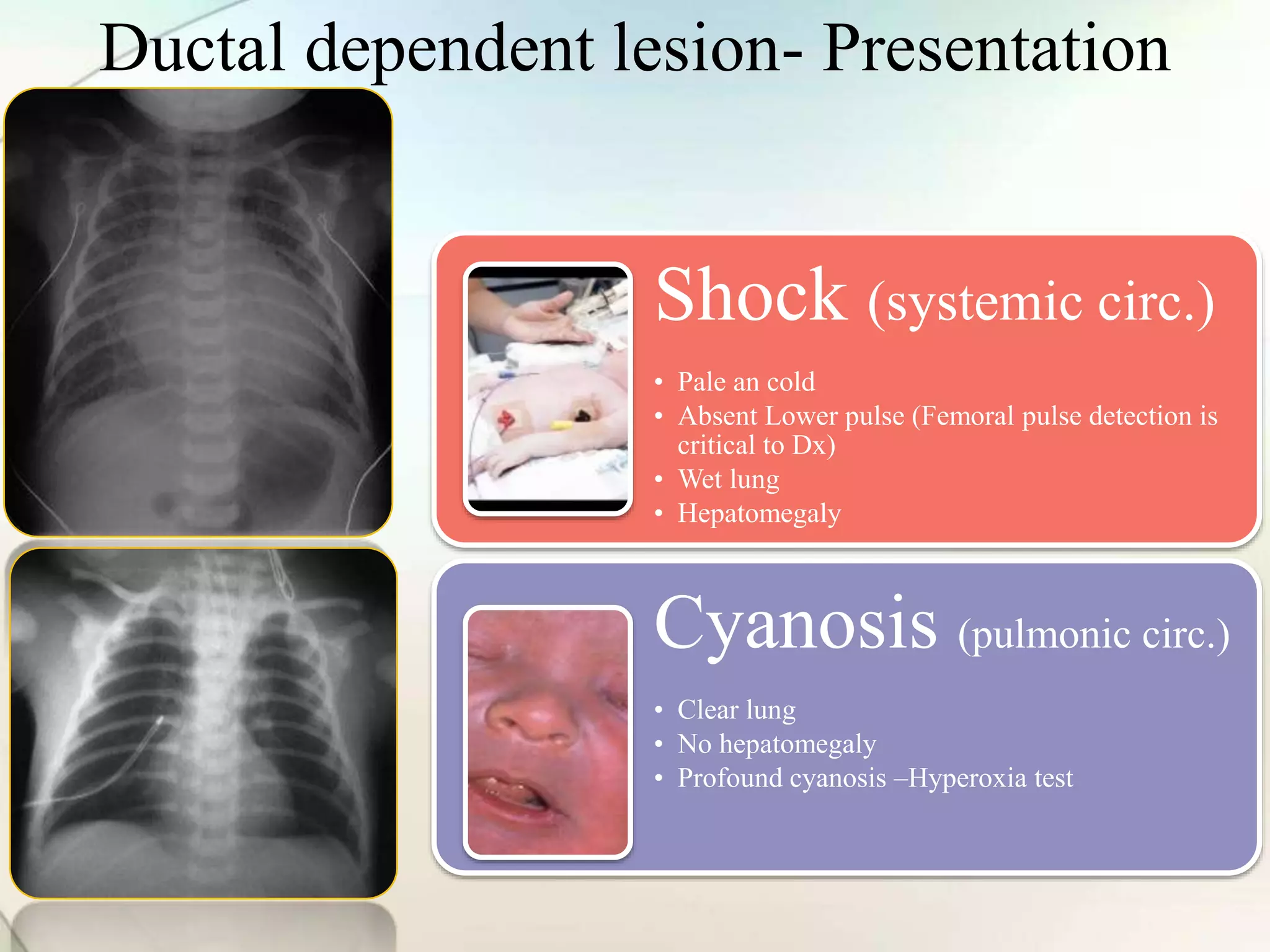Pediatric Cardiovascular emergency | PPTX