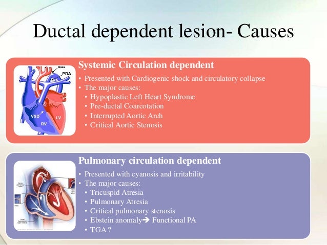 Pediatric Cardiovascular emergency