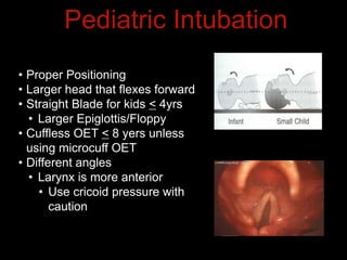 pediatric emergency.ppt