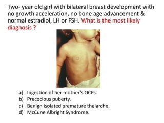 Pediatric endocrine revesion (part 1) | PDF