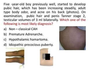 Pediatric endocrine revesion (part 1) | PPT