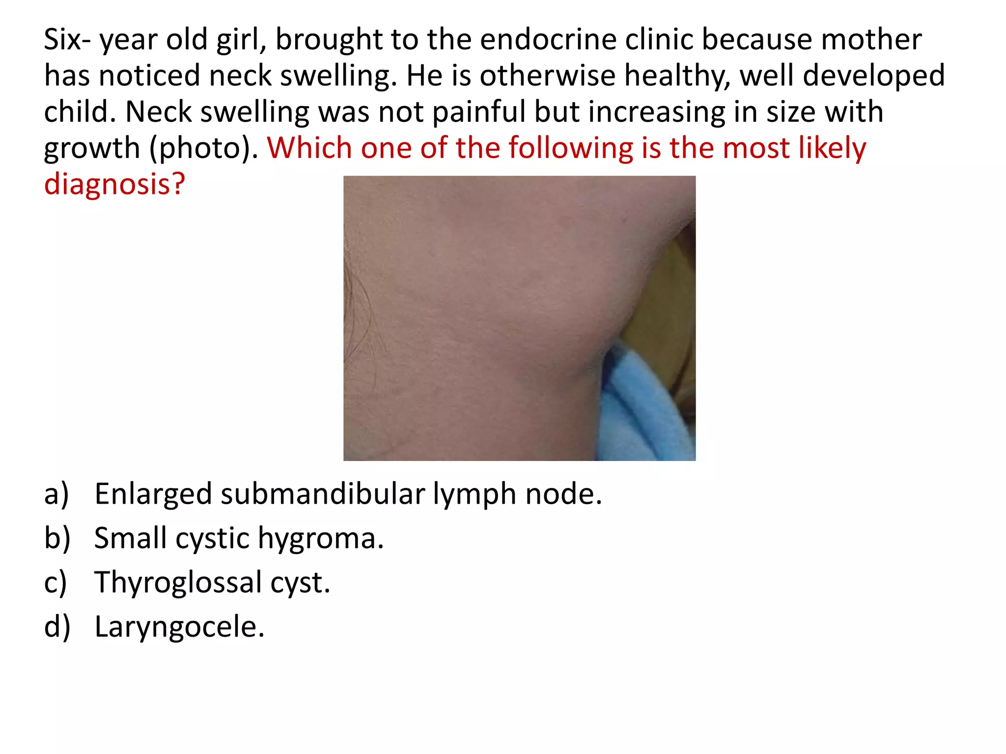 Pediatric endocrine review MCQs- part 5 | PDF