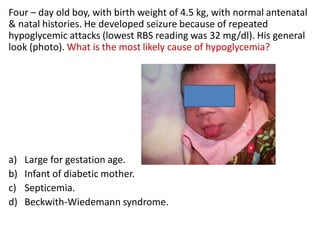 Pediatric endocrine review MCQs- part 5 | PDF