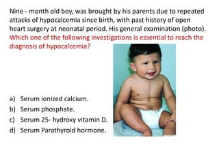 Pediatric Endocrine Review Mcqs Part 5 Pdf