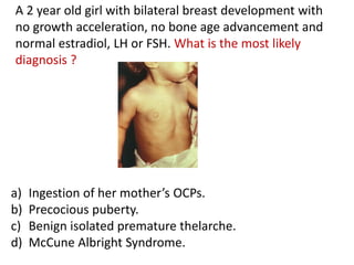 13 Year Old Breast Development